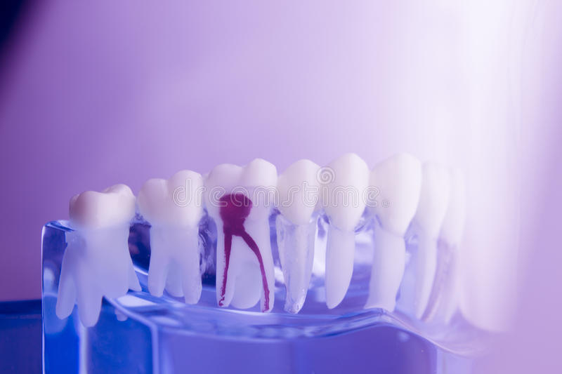What is Dental Plaque and how can I get rid of it? - Oberoi Dental Clinic